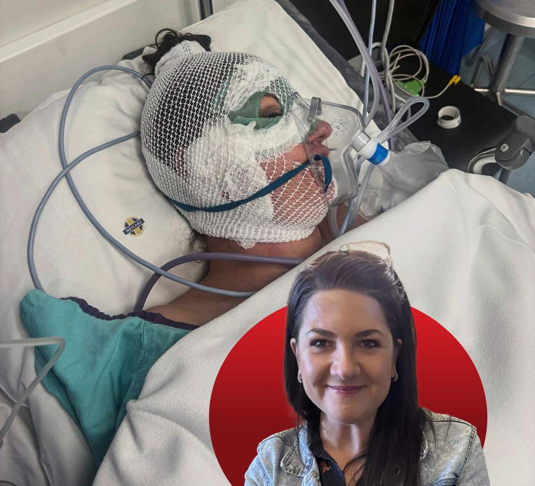 Ma val gesig eerste in vuurput: ‘Haar vel het soos papier afgekom ...