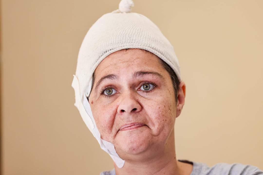 Nuwe hoop vir ma ná kwadfietsongeluk: 14 operasies later kry ek ...
